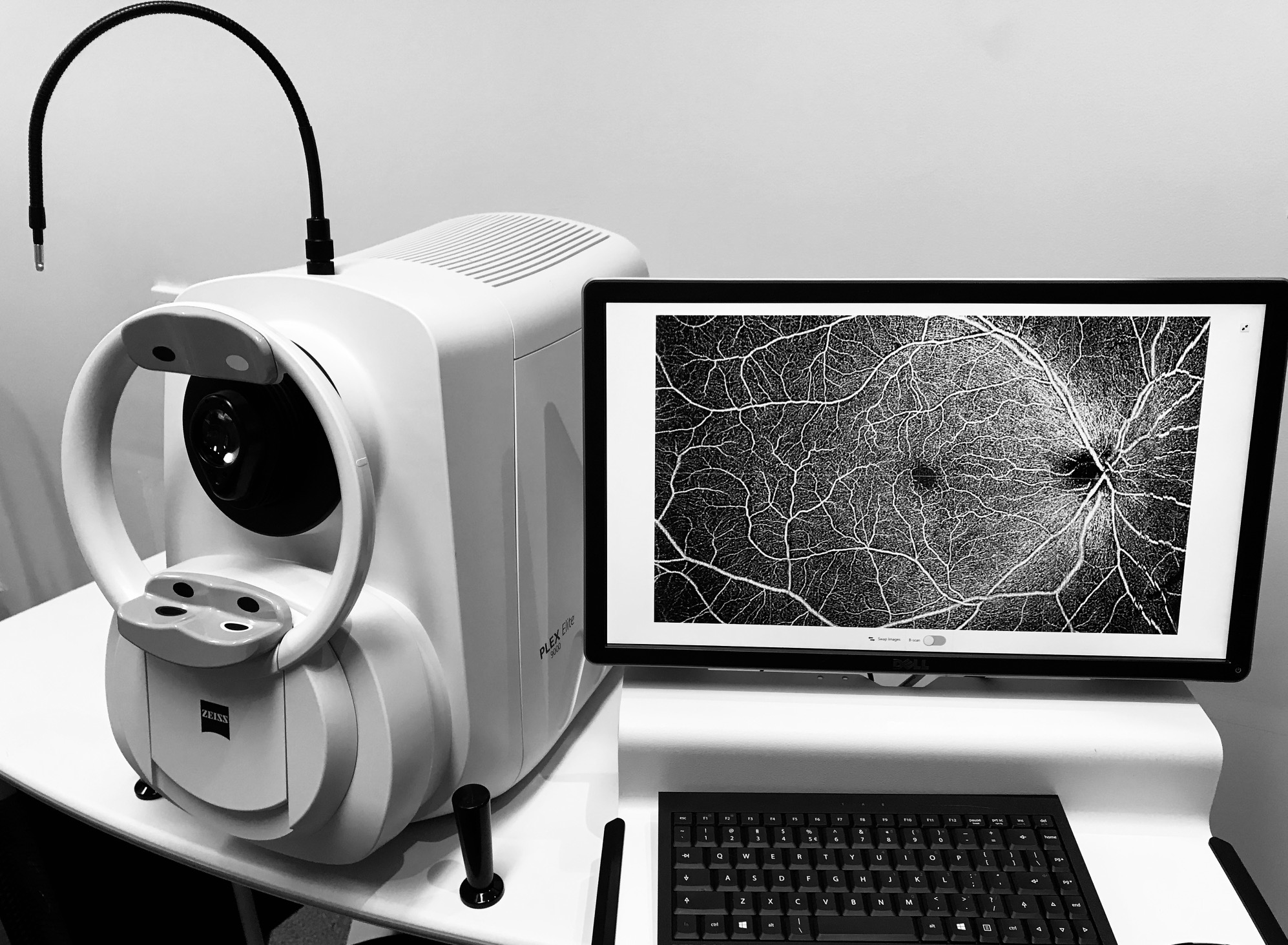 Optical Coherence Tomography | OCT Scan | City Eye Centre